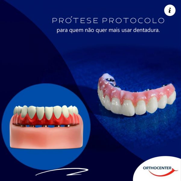 Prótese Protocolo: Entenda o que é e os diferenciais dessa técnica ...